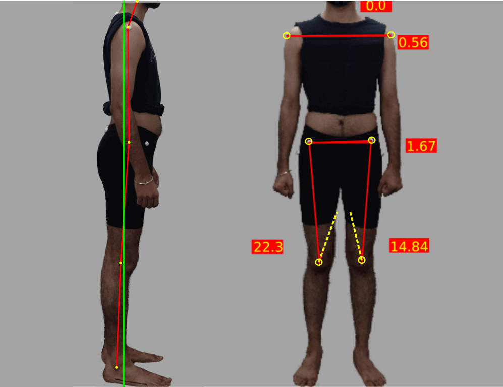Running Assessment: Complete physical examination of runners - auptimo